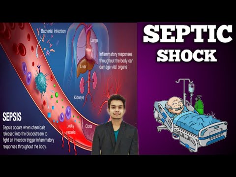 septic shock /pathophysiology and symptoms /diagnosis and treatment ...