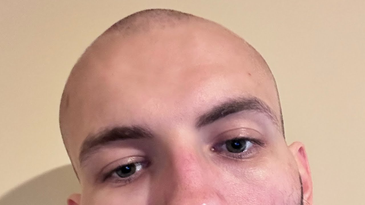 🔴Live🔴Getting a haircut (going bald) - YouTube
