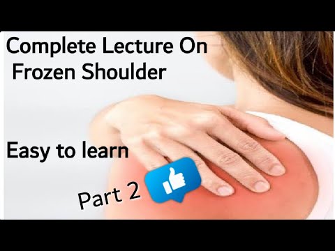 How to diagnose frozen shoulder? - YouTube