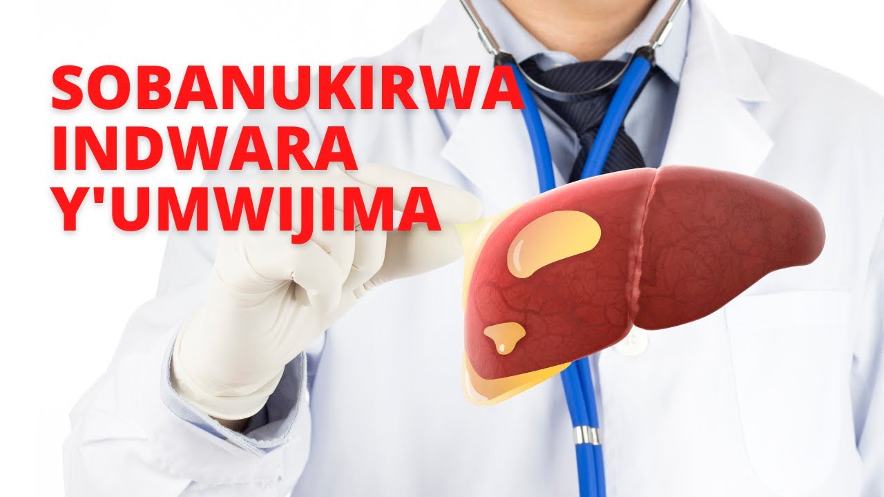 Ibimenyetso By'indwara Y'umwijima( sobanukirwa uko yandura, urukingo ...