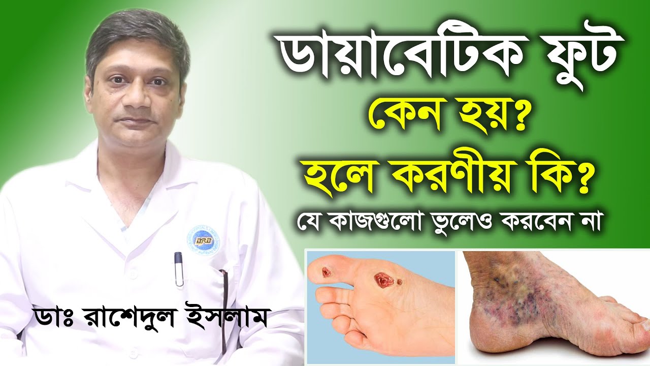 Diabetic Foot (ডায়াবেটিক ফুট) কেন হয়? হলে করণীয় কি? যে কাজগুলো ভুলেও ...