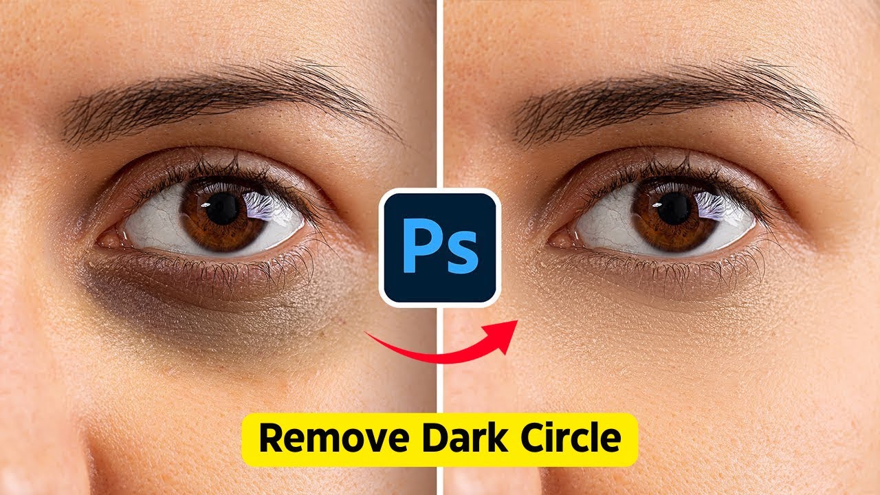 Remove Deep Dark Circle Photoshop Tutorial 2023 - YouTube