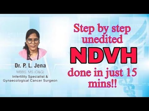 Step by Step Unedited NDVH in just 15 mins!! - YouTube