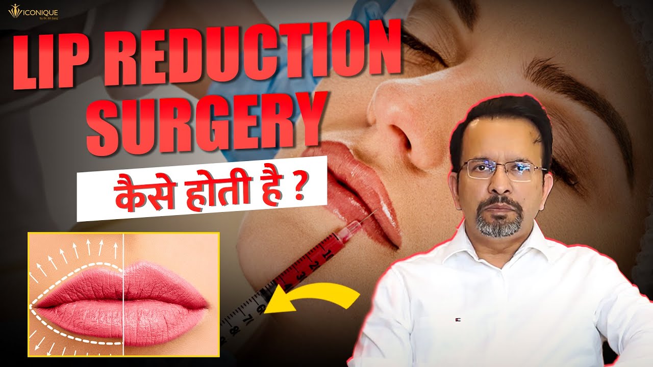 Lip Reduction Surgery कैसे होती है ? | Excessive Lip Treatment | Lip ...