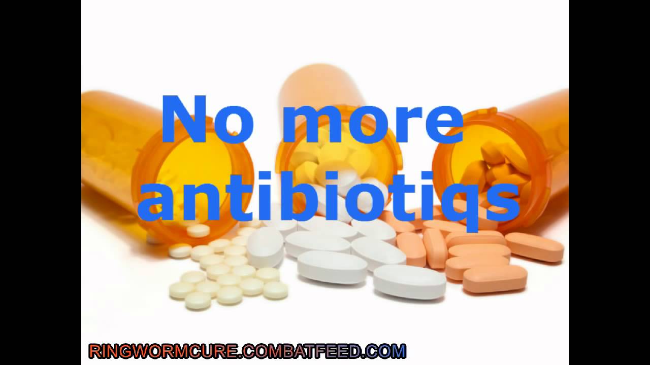 How to cure ringworm, ringworm cure in 10 days, Home treatment Guide ...