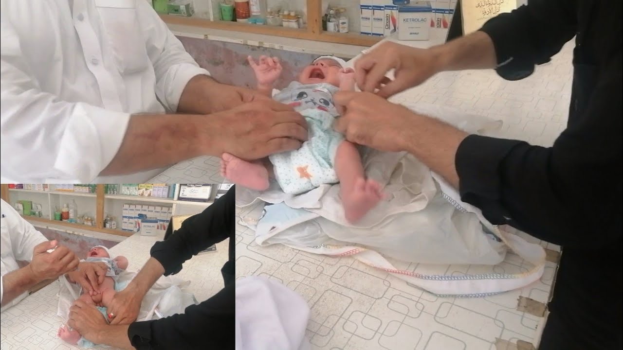 Baby boy ka Khatna Hu gaya Alhamdulillah 🥰 | Circumcision in Islam ...