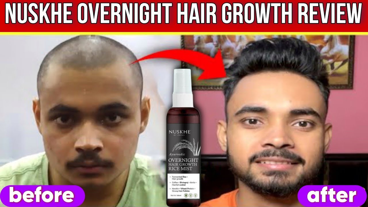 Nuskhe overnight Hair growth mist Review| nuskhe by paras overnight ...