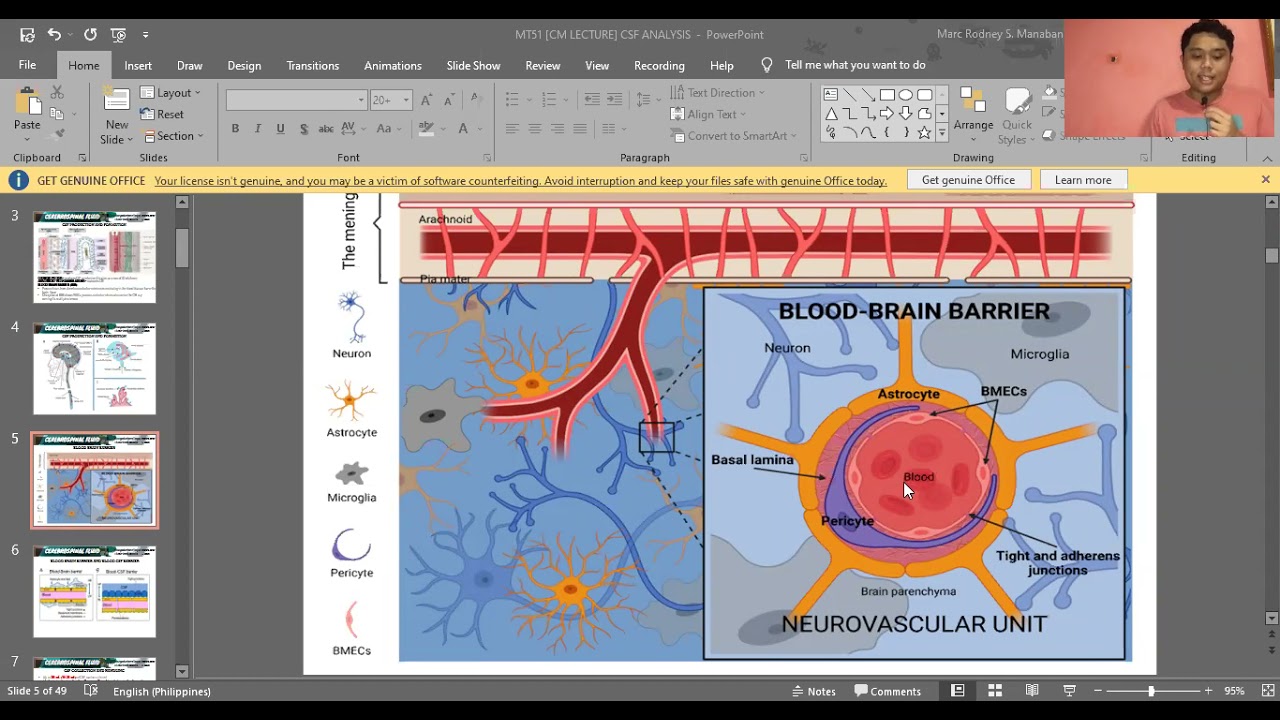 MT 51: Didactics | Clinical Microscopy Review (Cerebrospinal Fluid Analysis) - YouTube