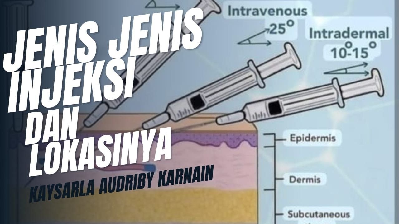 Jenis-jenis injeksi dan lokasinya - YouTube