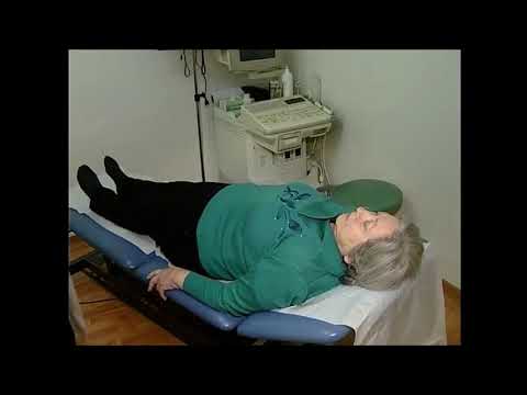 REVMATOİD ARTRİT, DR.ƏLİ ƏLİZADƏ