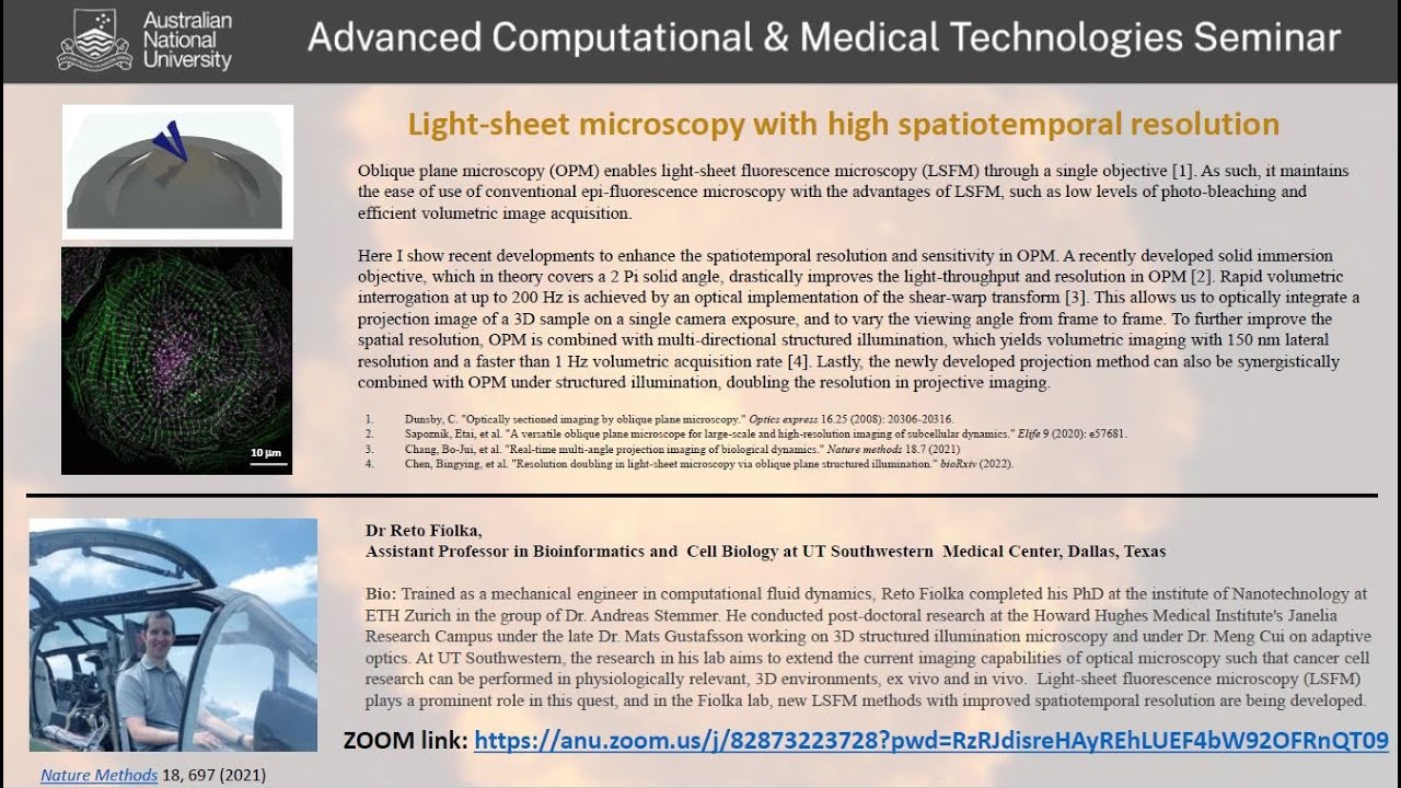 Light Sheet Microscopy Advantages | Shelly Lighting