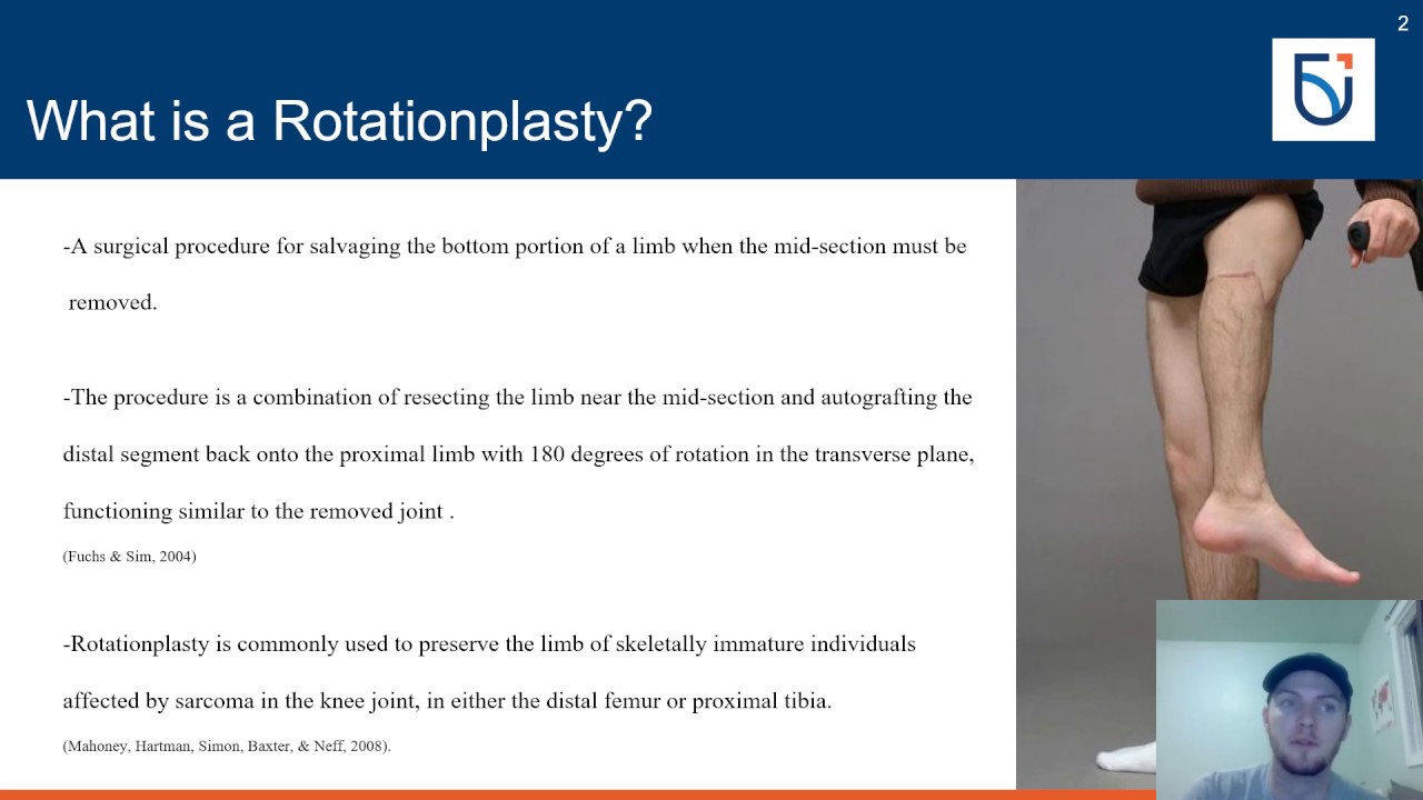 Rotationplasty: A Viable Surgical Alternative to Above-Knee Amputation ...