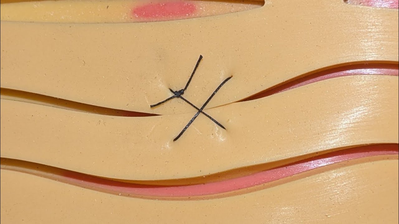Figure of 8 Suture (in 5 Steps) - YouTube