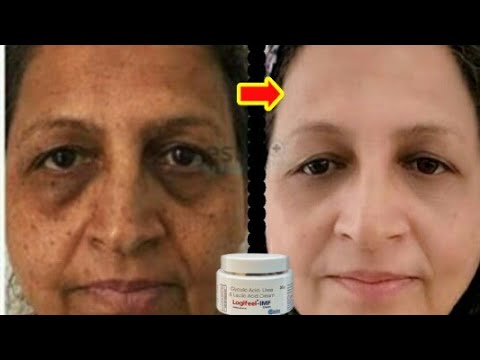 Logifeel-IMF Cream | acne | Pigmentation | Wrinkles | scars skin ...
