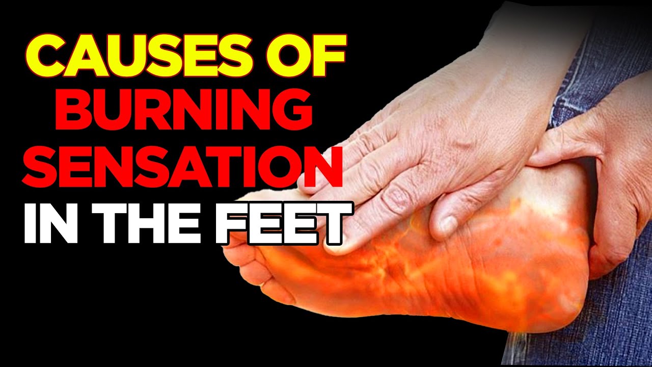 BURNING FEET: 10 CAUSES of TINGLING and PAIN in the FEET - YouTube