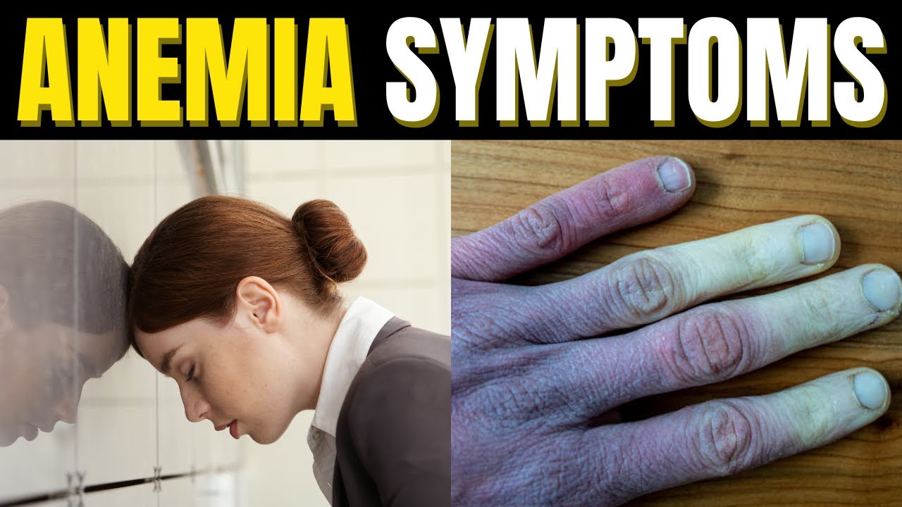 10 anemia symptoms you shouldn't ignore | Hemoglobin deficiency ...