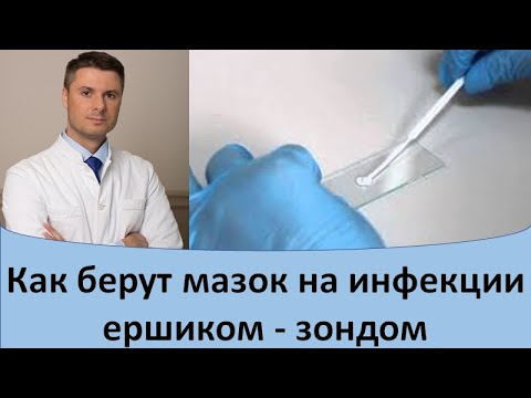 Как берут мазок на инфекции ершиком - зондом