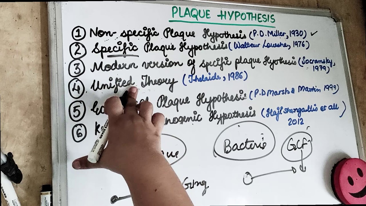 plaque hypothesis I dental plaque (part 4) - YouTube