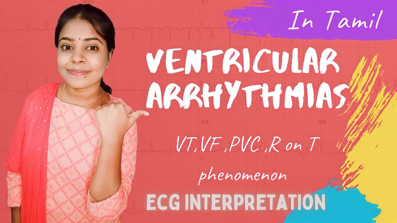 Ventricular Arrhythmias | ECG Interpretation in Tamil | VT ,VF ,PVC ,R ...