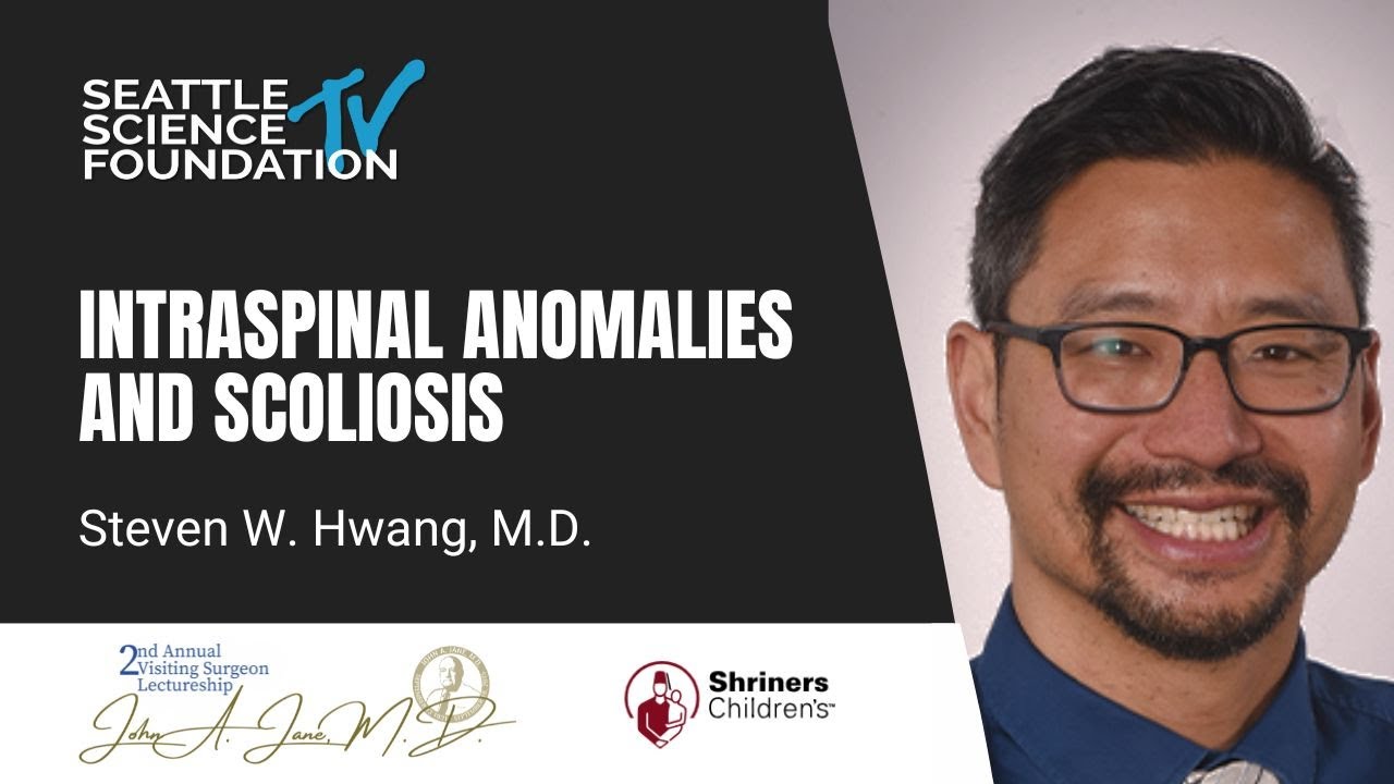 Intraspinal Anomalies & Scoliosis - Steven W. Hwang, M.D. - YouTube