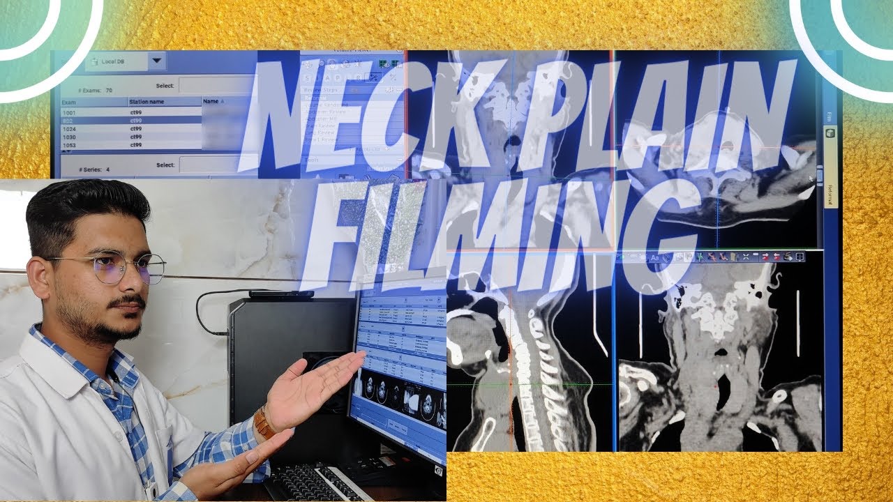CT Scan Neck plain filming process| CT Scan Oral cavity with Neck plain ...