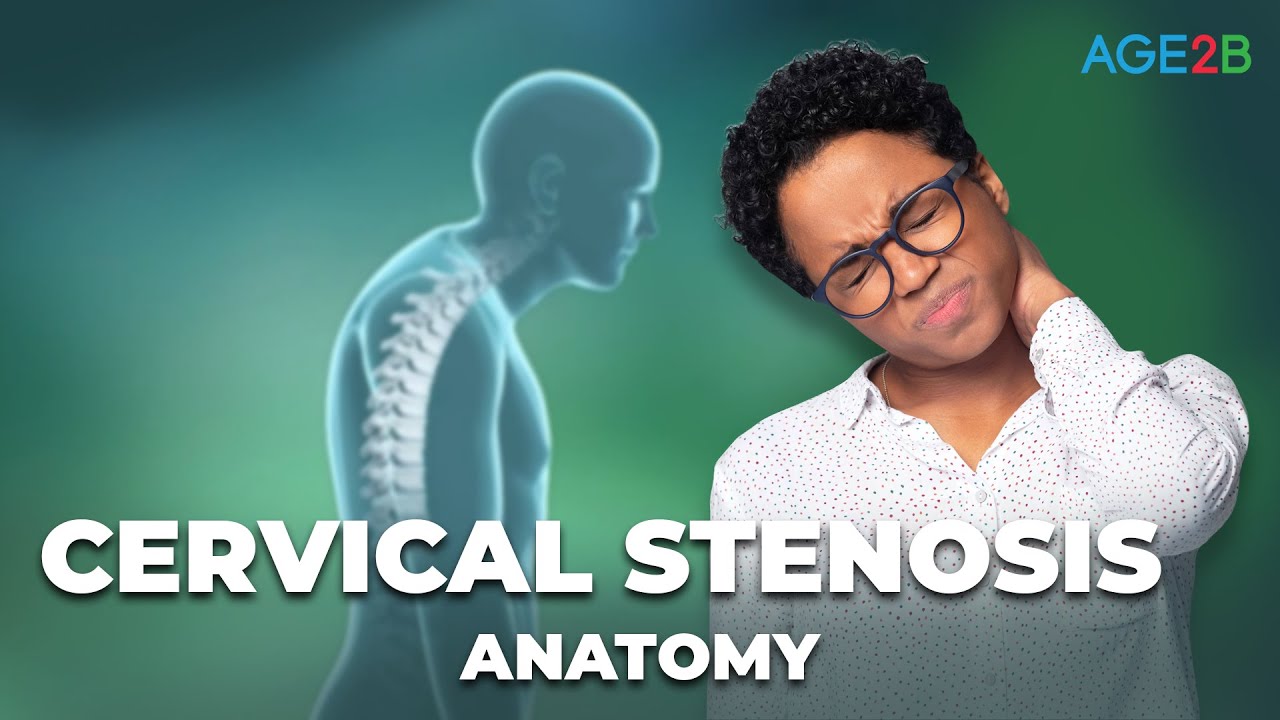 What Is Cervical Stenosis Best Cervical Stenosis Exercises