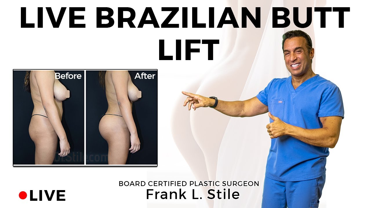 Live BBL - Brazilian Butt Lift - YouTube