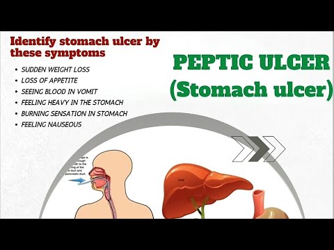 LIVER লিভার ULCER & TUMOUR টিউমার patient #medinipur live result ☎️(+91 ...