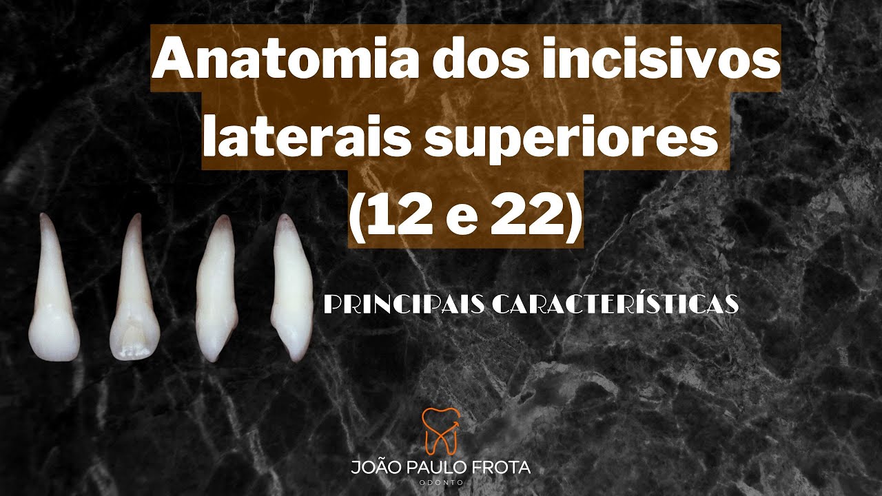 CARACTERISTICAS DOS INCISIVOS LATERAIS SUPERIORES l ANATOMIA DENTAL ...