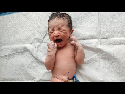 Dimple newborn baby immediately after birth looks so adorable after ...