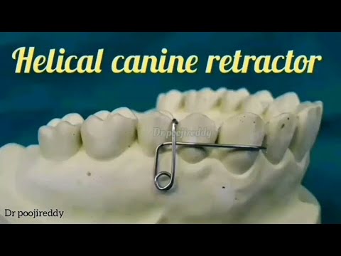 Helical canine retractor|fabrication of helical canine retractor |Dr ...