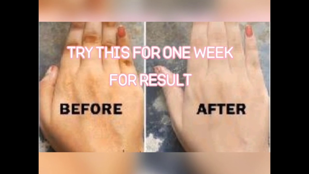 How to lighten dark knuckles #knuckles #dark|useful for scrub and ...