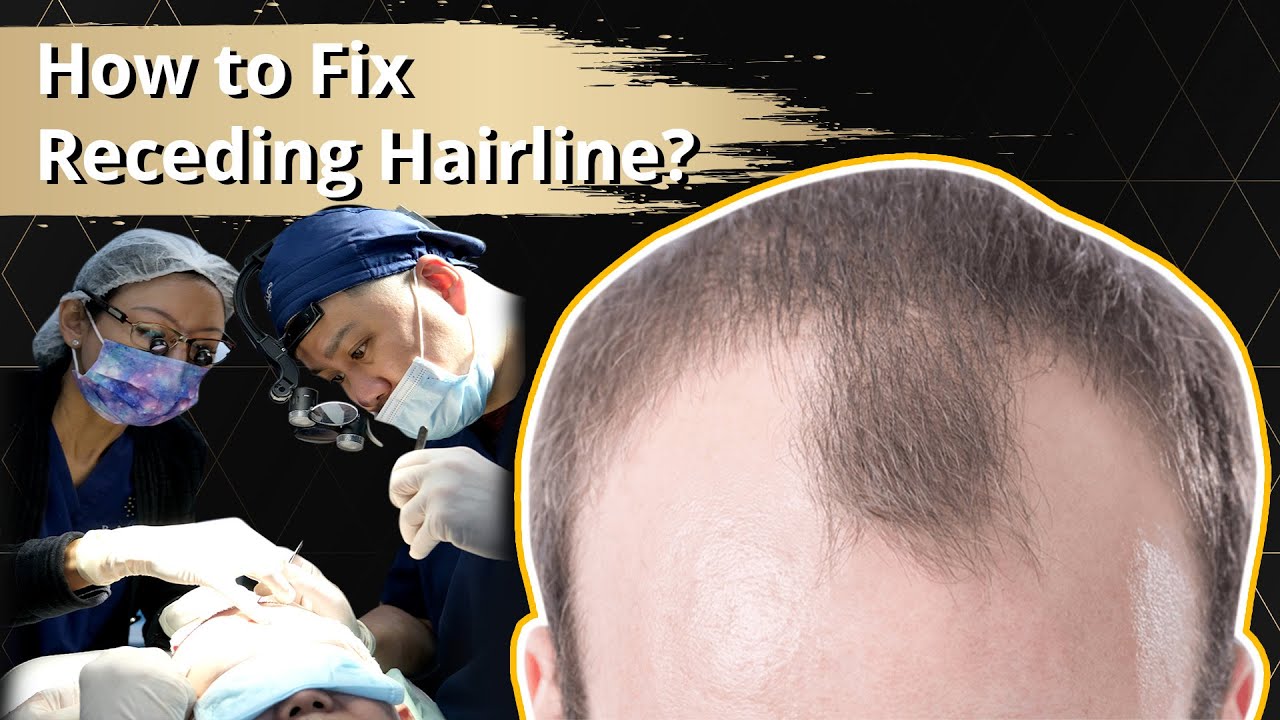 How To Fix Receding Hairline? | Radium Medical Aesthetics - YouTube