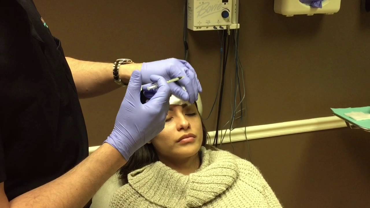 Dysport & Restylane Lyft Injection by Dr. Naderi to Forehead Wrinkles ...
