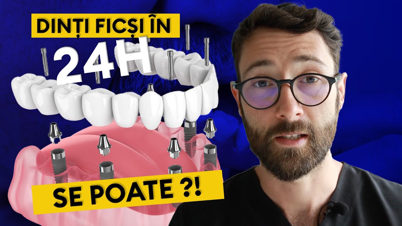 TOTI DINTII Pe 6 Implanturi. Transformare UIMITOARE a unui om. - YouTube