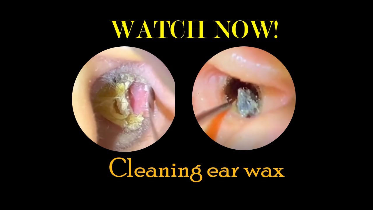 ASMR Ear Wax Cleaning | Satisfying Video , Cleaning Sound - YouTube