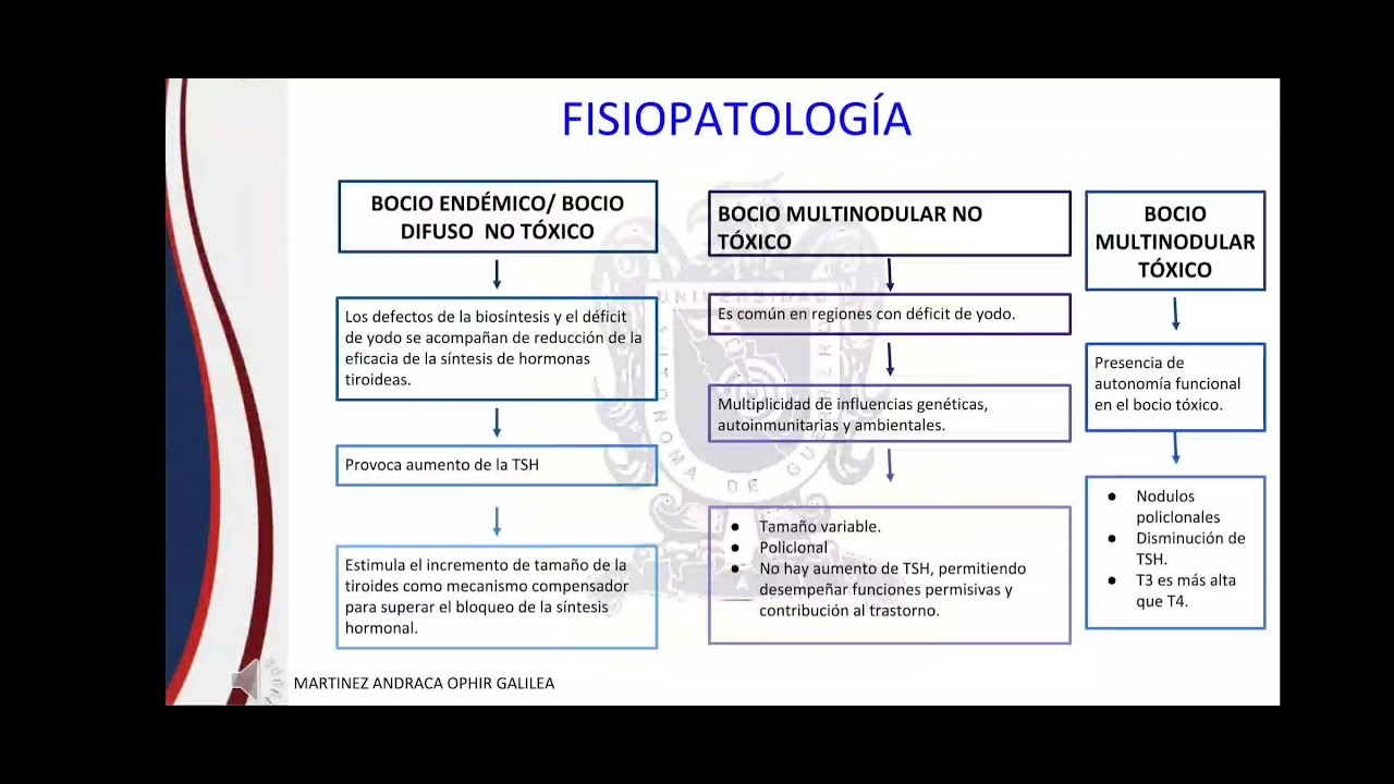 Bocio, Endocrinología. Universidad Autónoma de Guerrero Facultad de ...