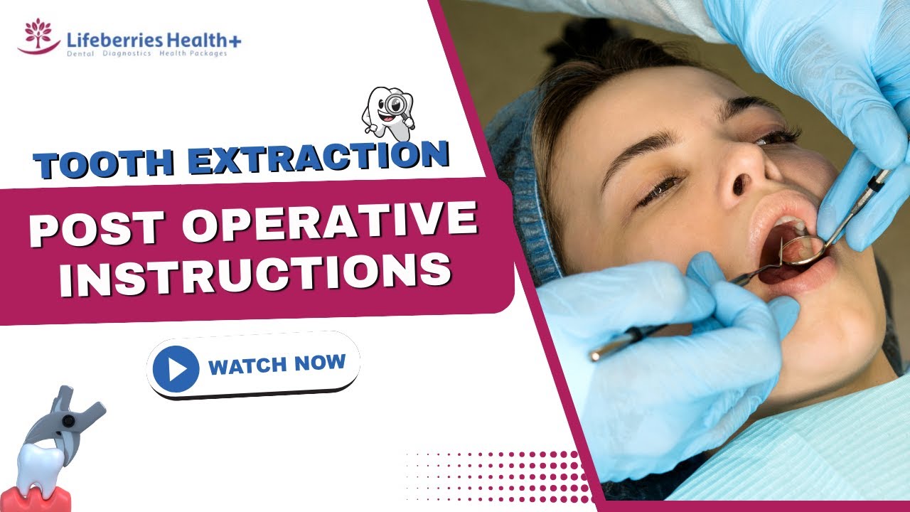 Tooth Extraction: Essential Post-Operative Instructions | Lifeberries ...