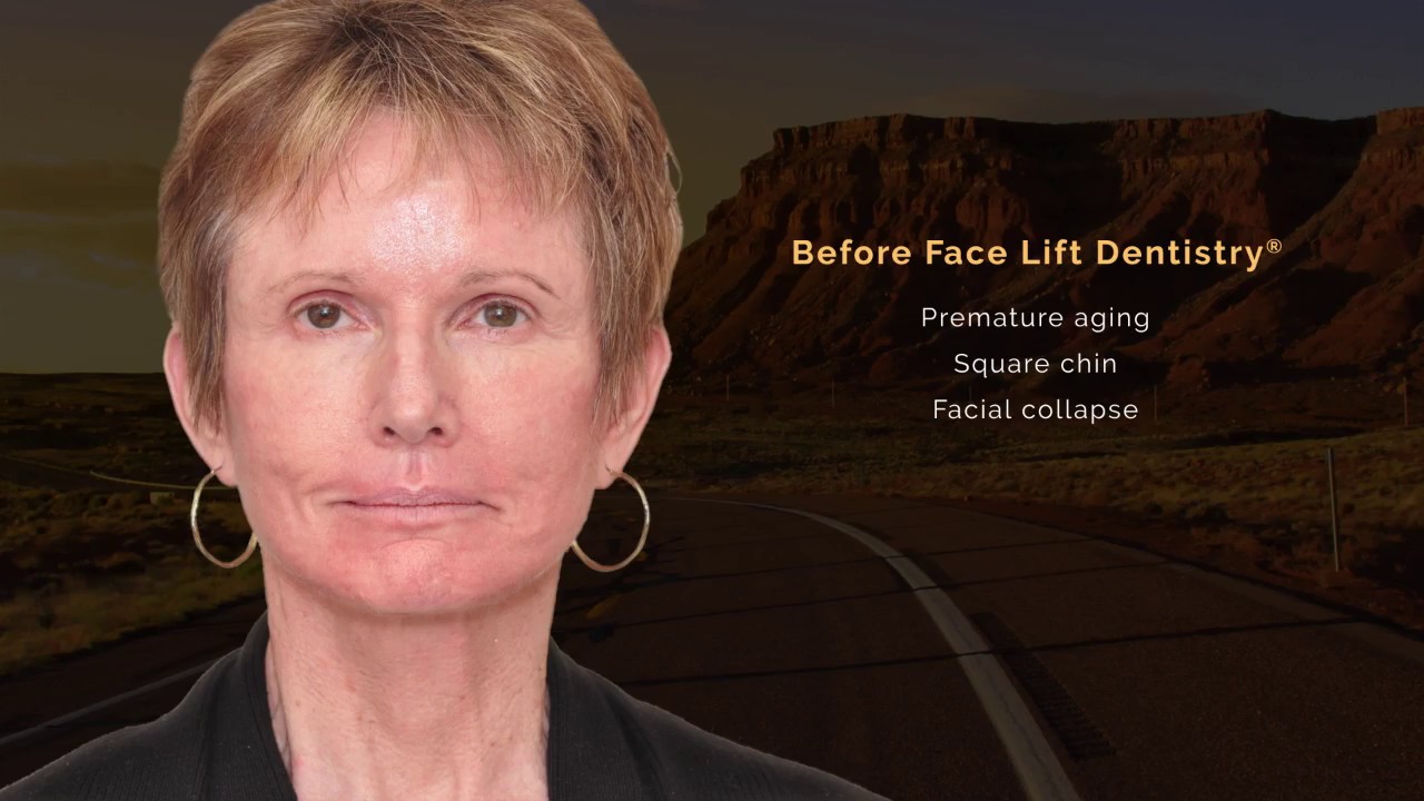 JawTrac® Jaw Alignment and Bite Correction Reverses Facial Collapse ...