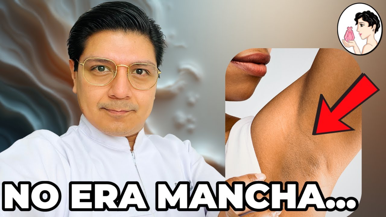 😱 Cómo ACLARAR las AXILAS OSCURAS [Dermatólogo explica] - YouTube
