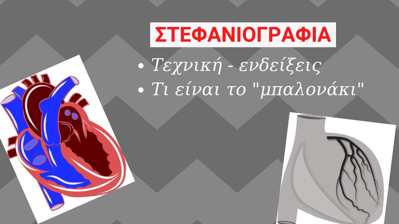 Στεφανιογραφία - Πως και γιατί γίνεται - YouTube