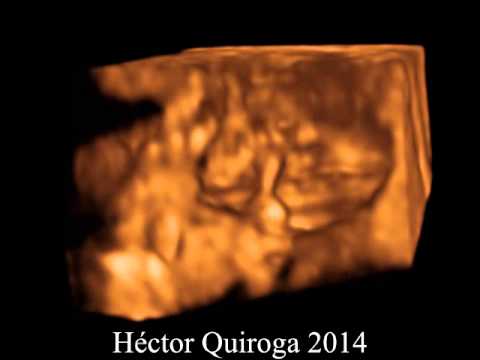 Imagenes y videos de corazón fetal en 3D-4D y modo invertido - YouTube