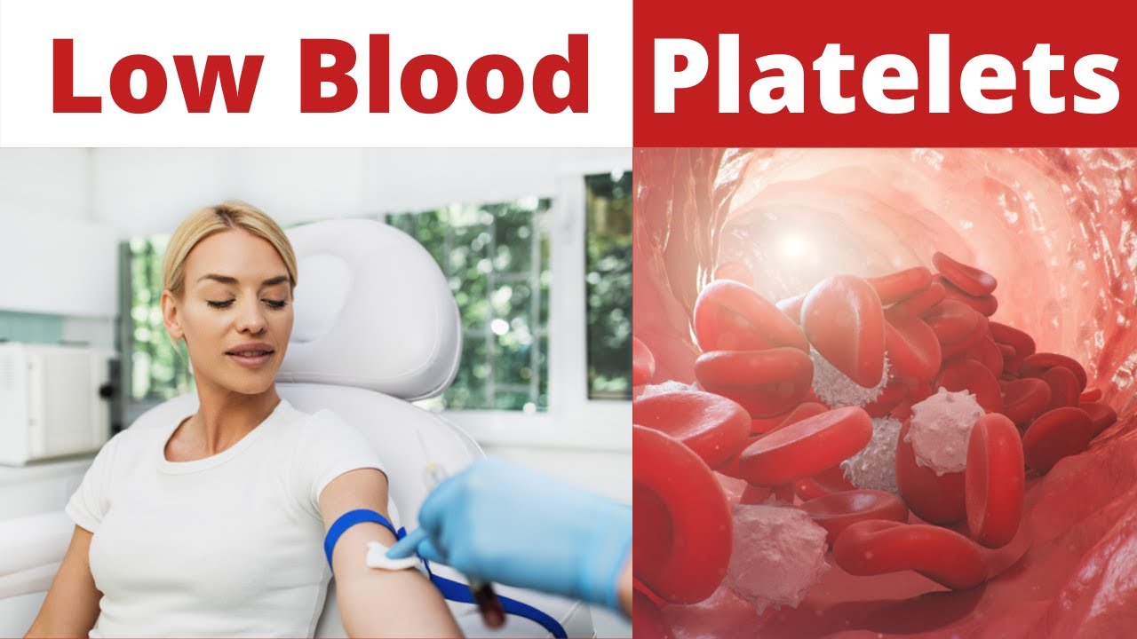 Low Platelets: What Causes it, How do you treat it? - YouTube