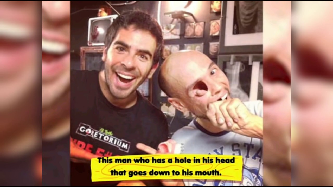 Weird and Unusual Body Parts - YouTube