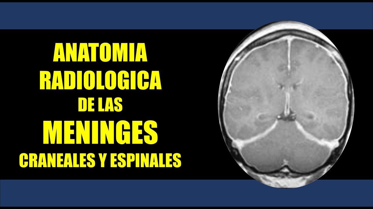 Anatomía radiológica de las meninges (craneales y espinales) - YouTube