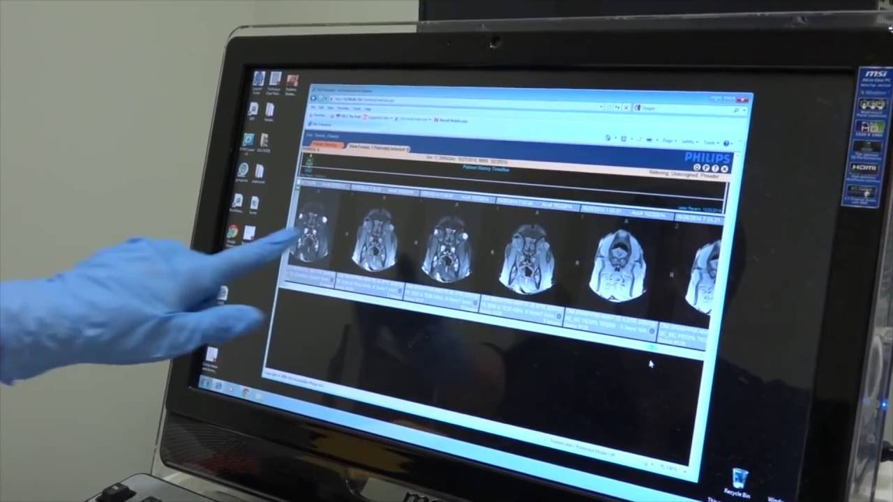 Portable MRI developed at Los Alamos - YouTube