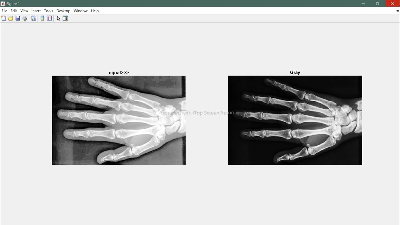 Basic Of Image Processing Using Matlab 1 Imread Imshow Rgb2gray Imhist Histeq Youtube