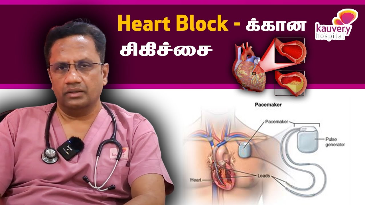 Heart Block Treatments | இதய அடைப்புகளுக்கான சிகிச்சை - YouTube