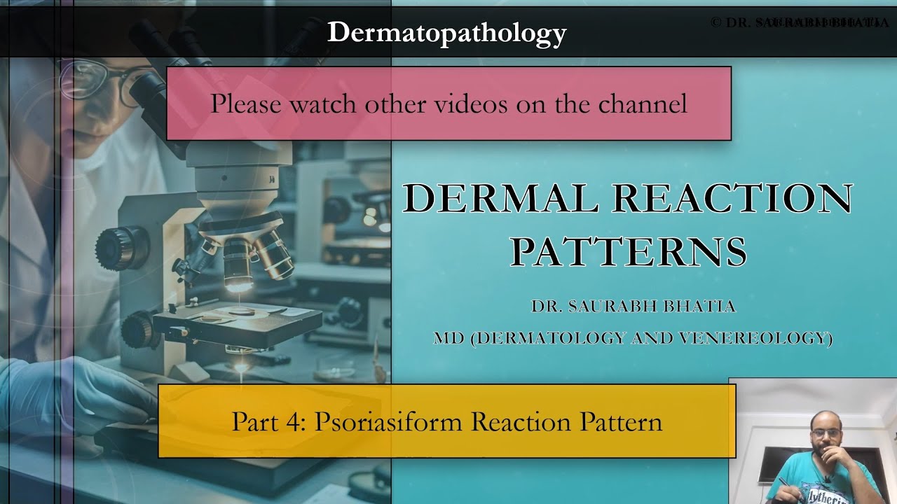 Dermatopathology - IV - Psoriasiform Tissue Reaction Pattern - YouTube
