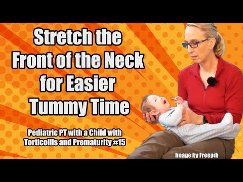 #15 Stretch the Front of the Neck for Easier Tummy Time: Pediatric PT ...